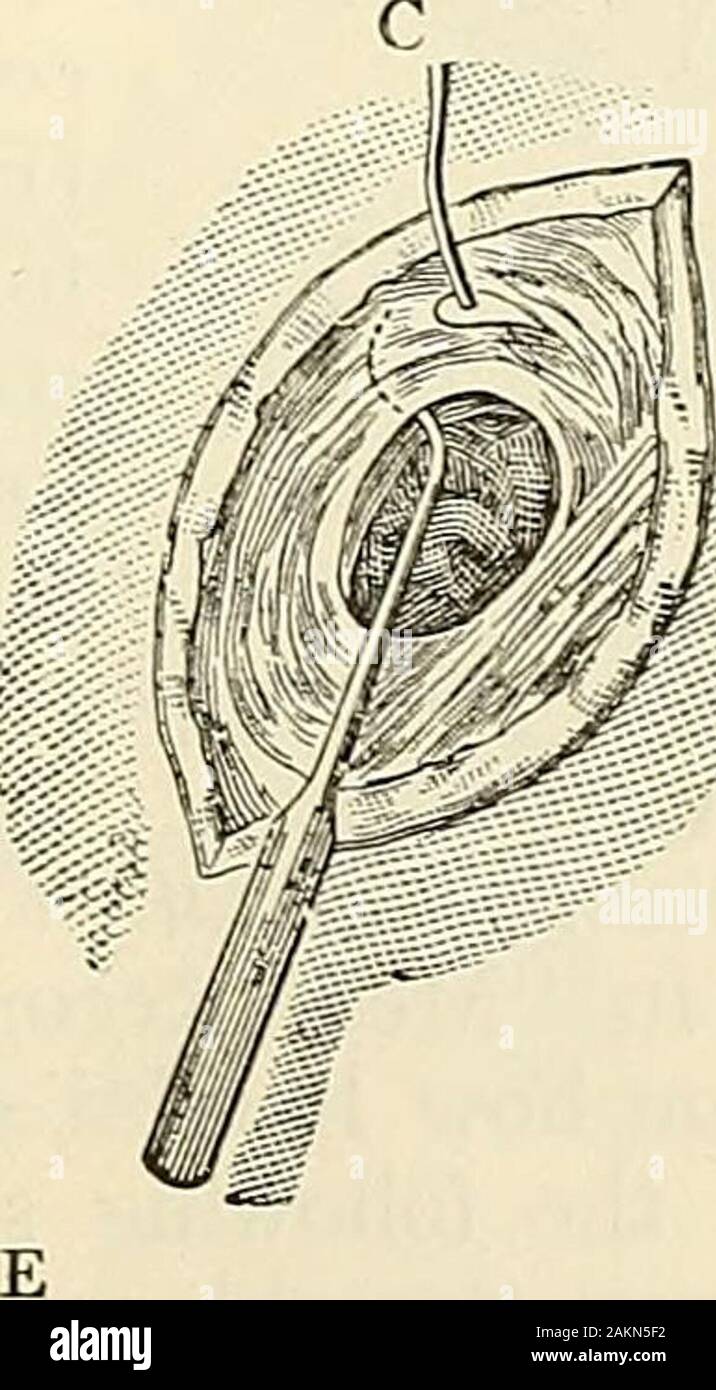 Modern surgery, general and operative Stock Photo - Alamy