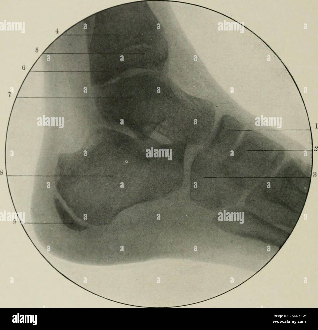 American practice of surgery : a complete system of the science and art ...