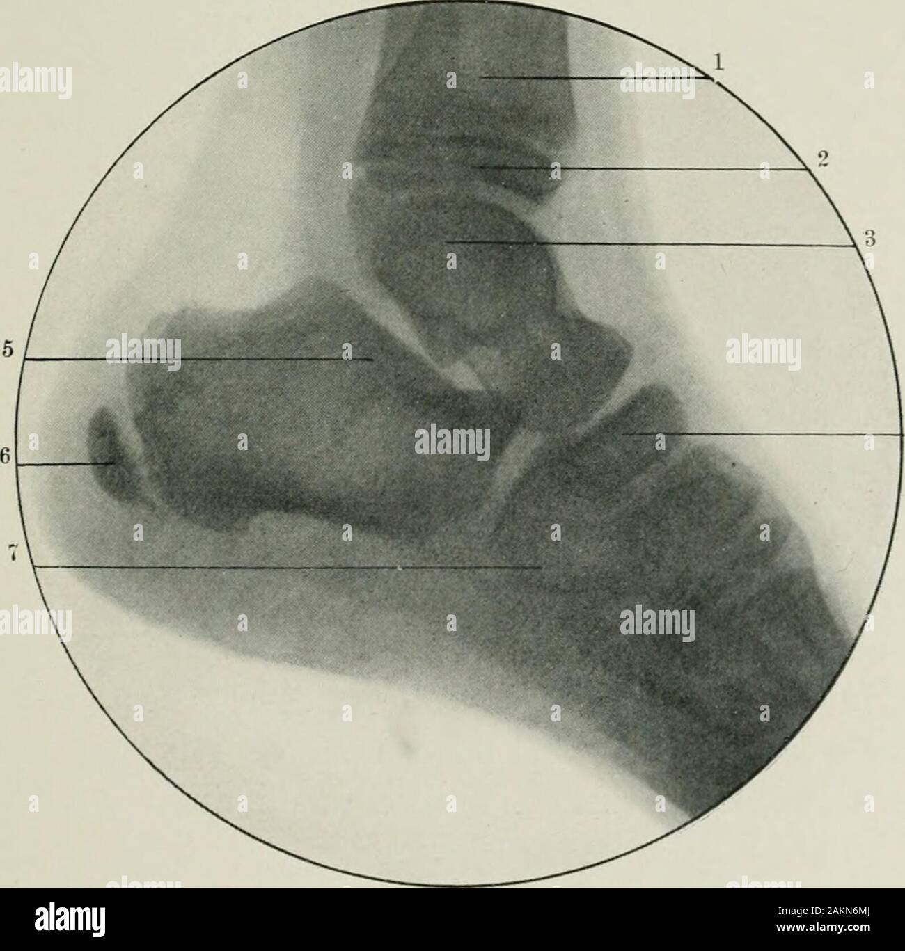 American practice of surgery : a complete system of the science and art ...