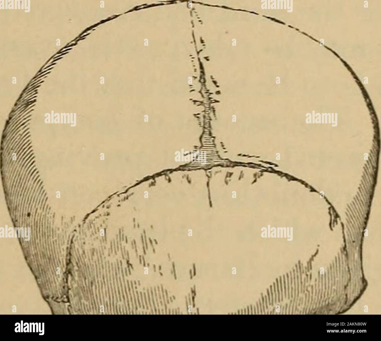 Posterolateral Fontanelle