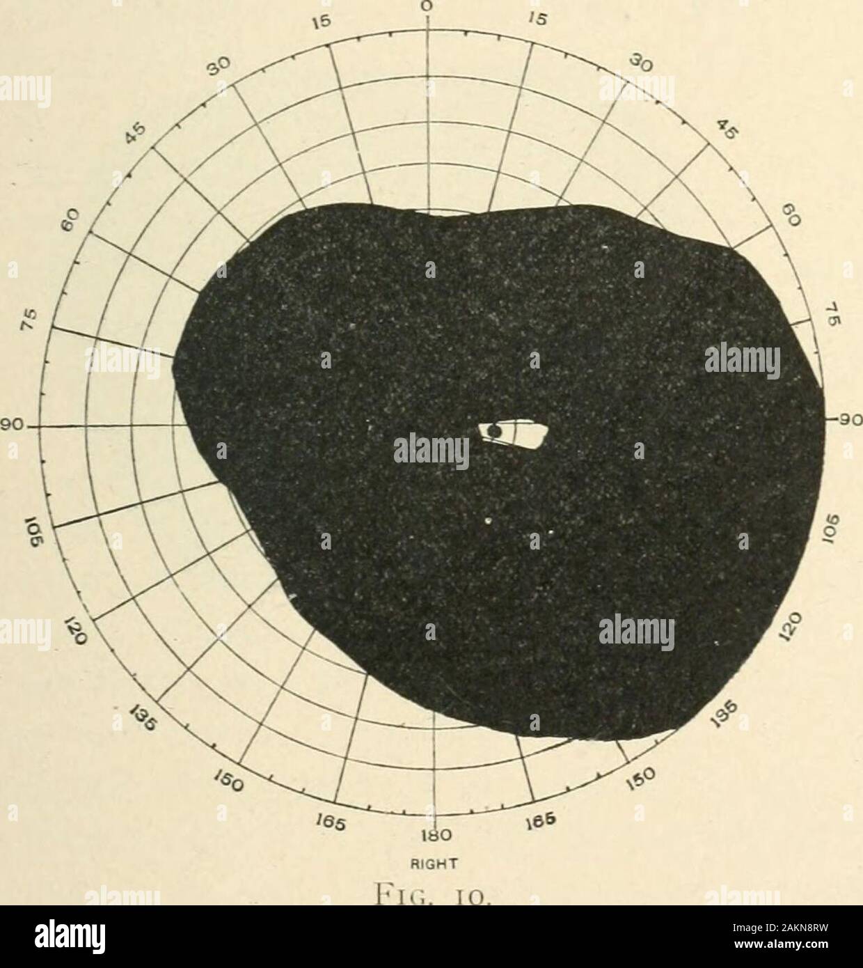 Cardiac_disease hi-res stock photography and images - Alamy