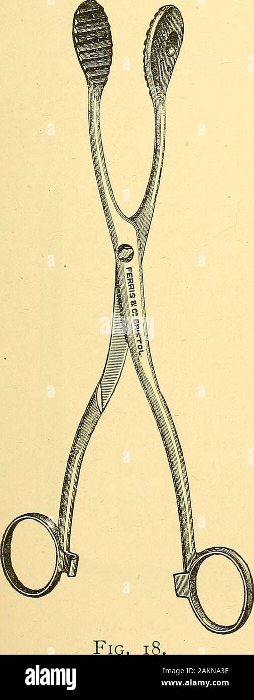 Abdominal surgery . found avery large forceps on the same principle ...