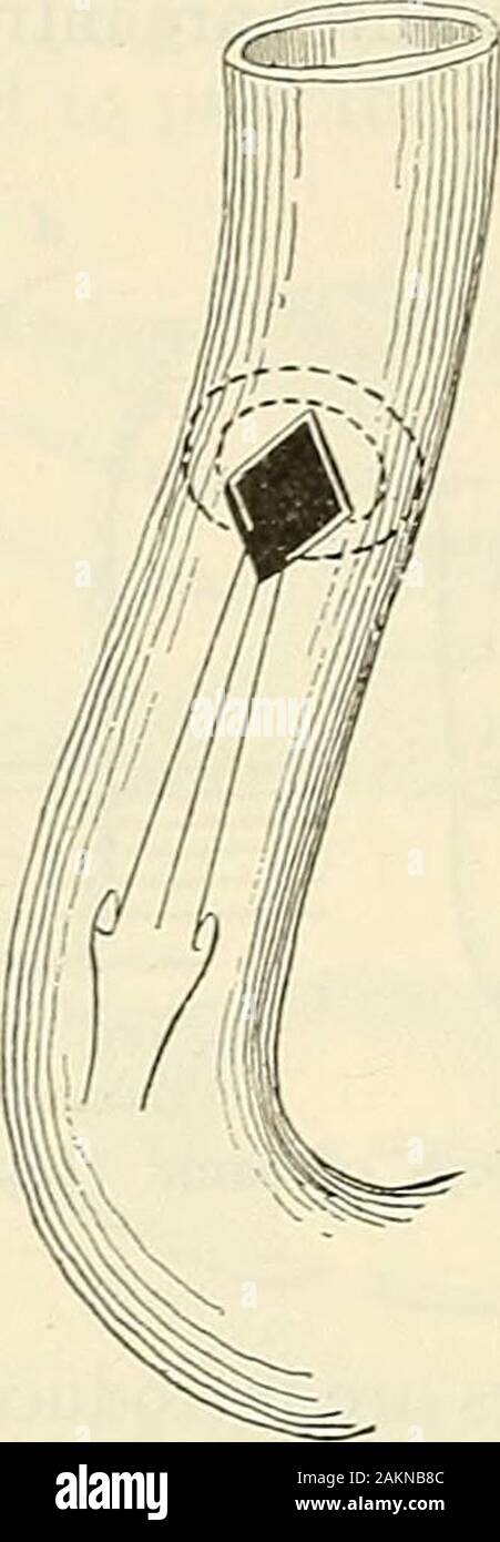 Modern surgery, general and operative . d g,the mesentery (J. Shelton ...