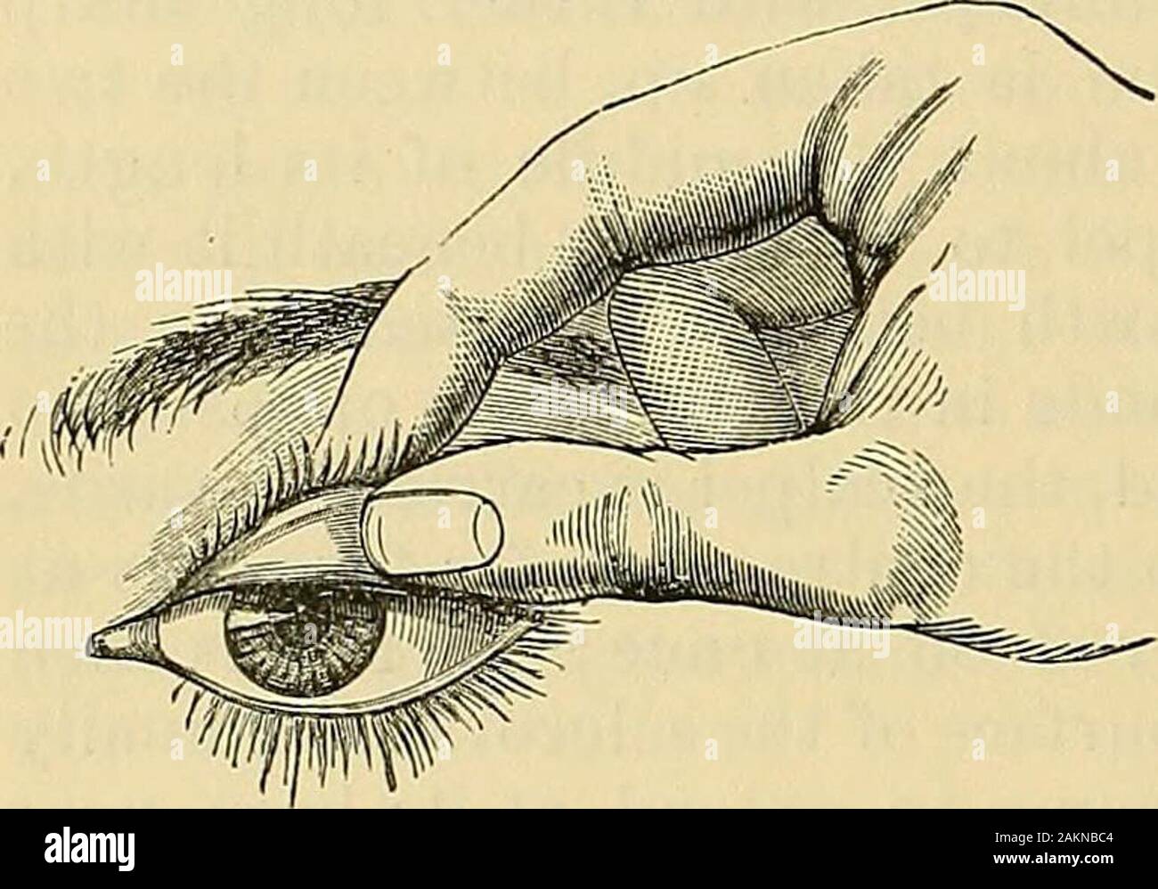 The science and art of surgery : being a treatise on surgical injuries ...