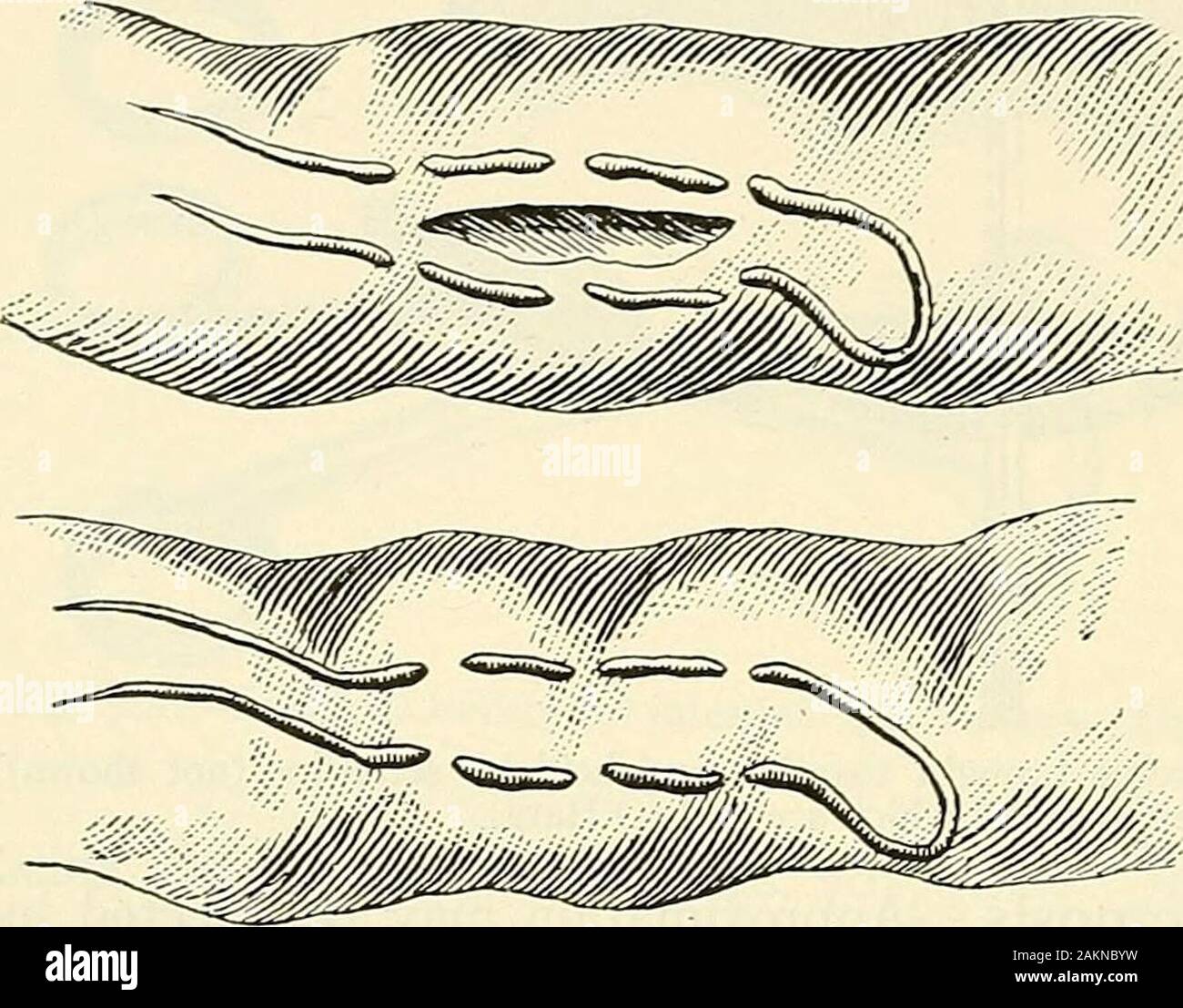 Modern surgery, general and operative . eof a pair of forceps. Theother ...