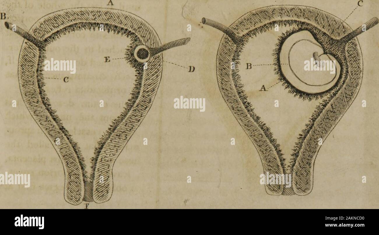 Gravid uterus hi-res stock photography and images - Alamy