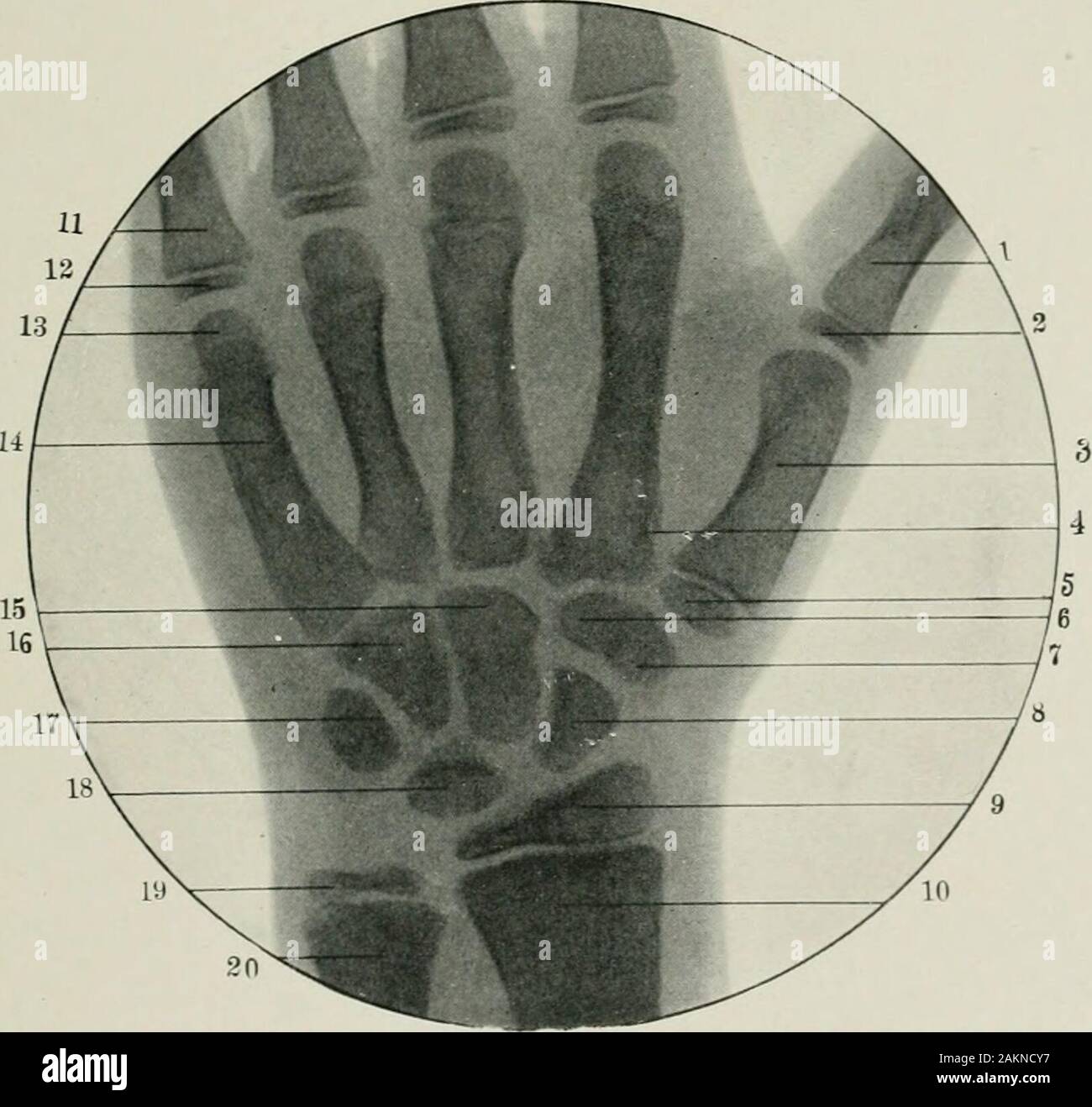 American practice of surgery : a complete system of the science and art ...