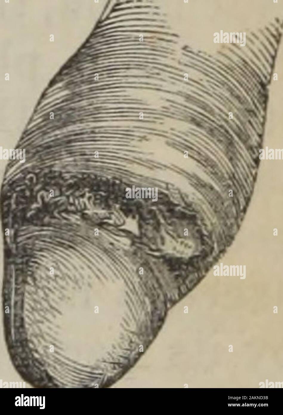 The principles of surgery . ct; commonly surrounded by consi-derable ...