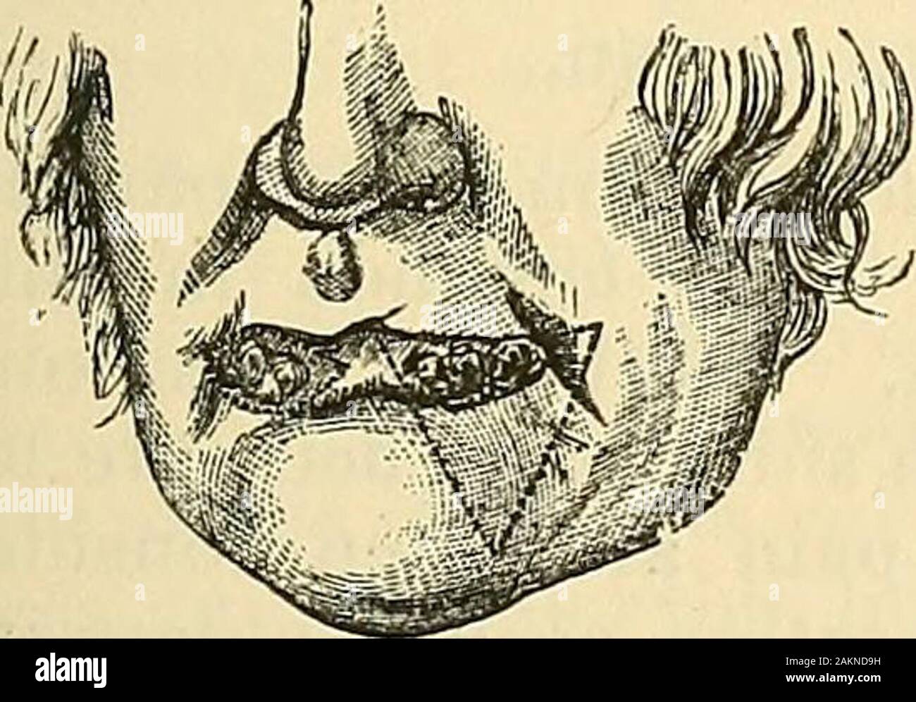 Prominent incisors hi-res stock photography and images - Alamy