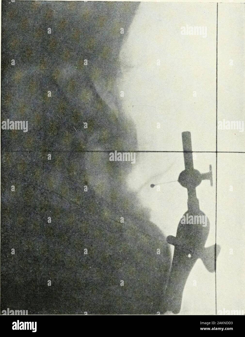 Ocular structures important hi-res stock photography and images - Alamy