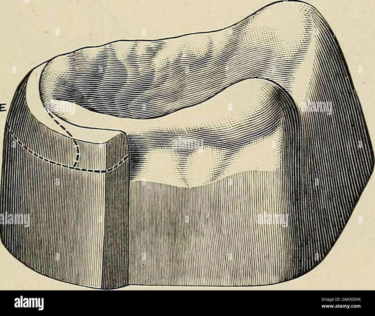 Alveolar ridge hi-res stock photography and images - Alamy