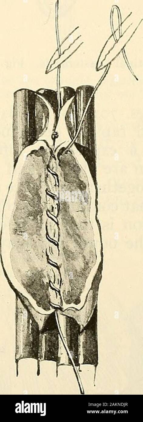Modern surgery general operative hi-res stock photography and images ...