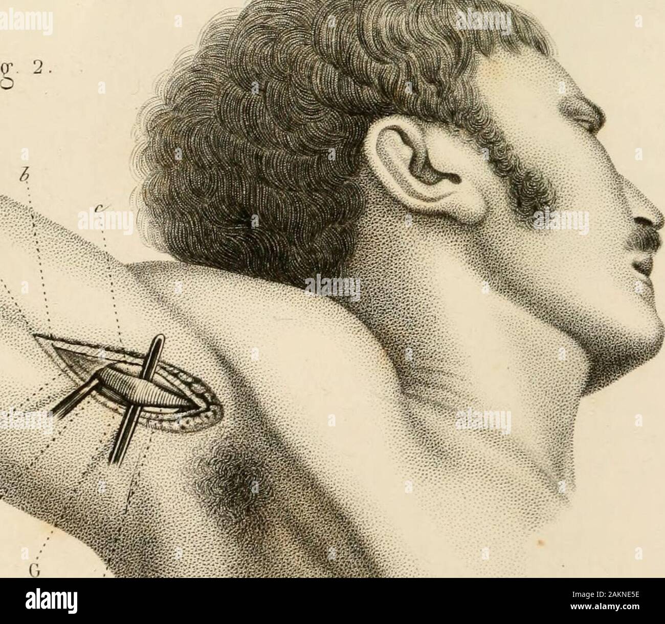 Anatomie du muscle biceps hi-res stock photography and images - Alamy