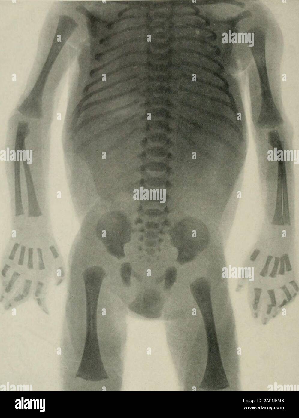 American practice of surgery : a complete system of the science and art ...