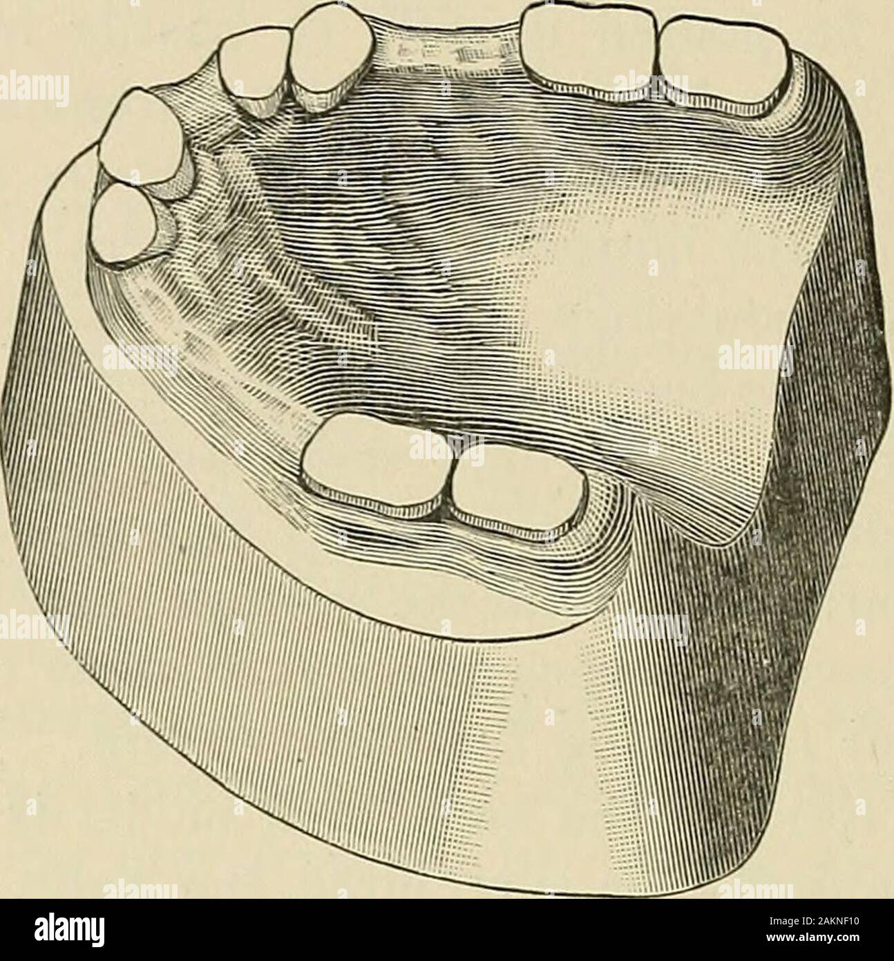 A practical treatise on mechanical dentistry . t, is frequently forced ...
