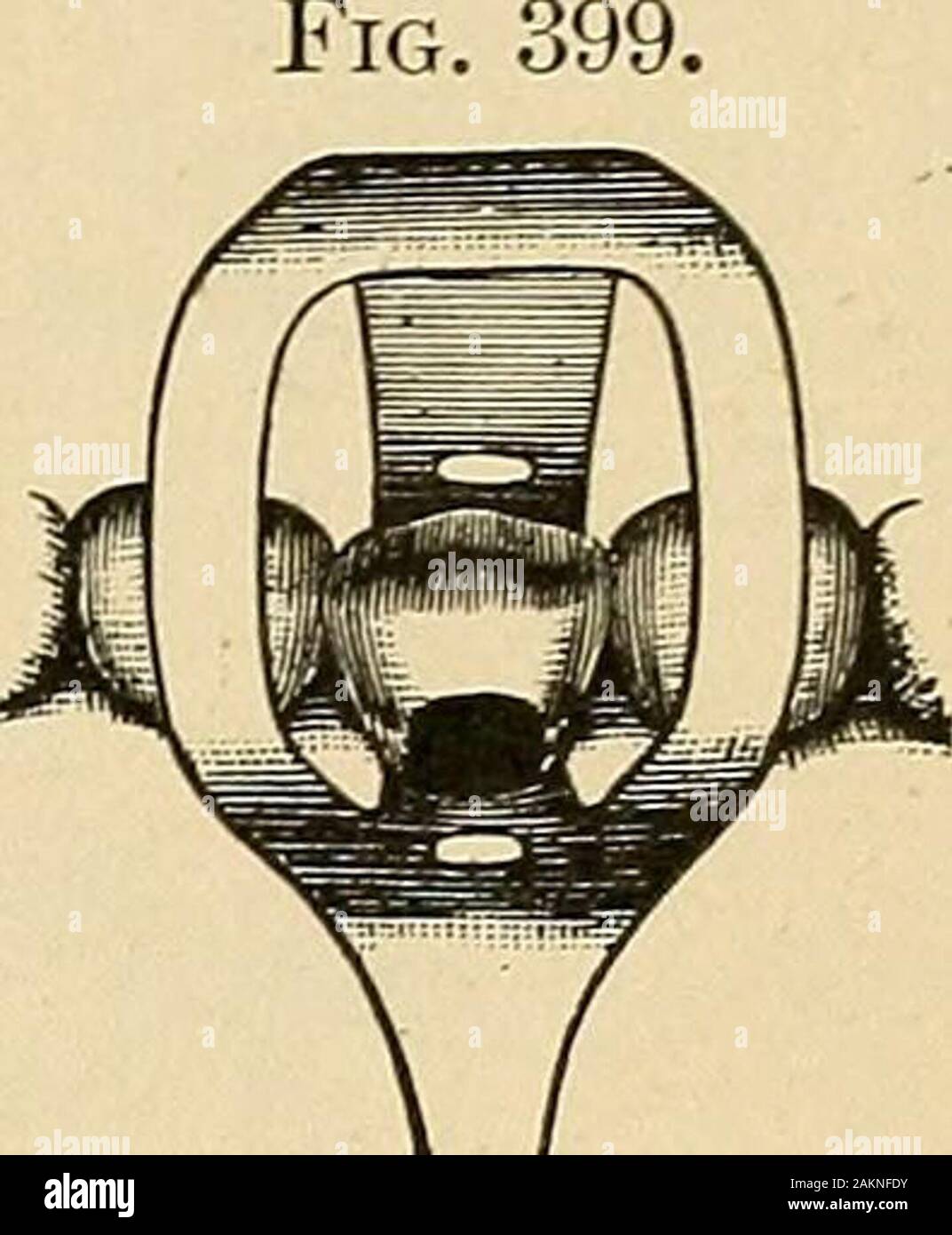 Principles and practice of operative dentistry . How cervix clamp ...