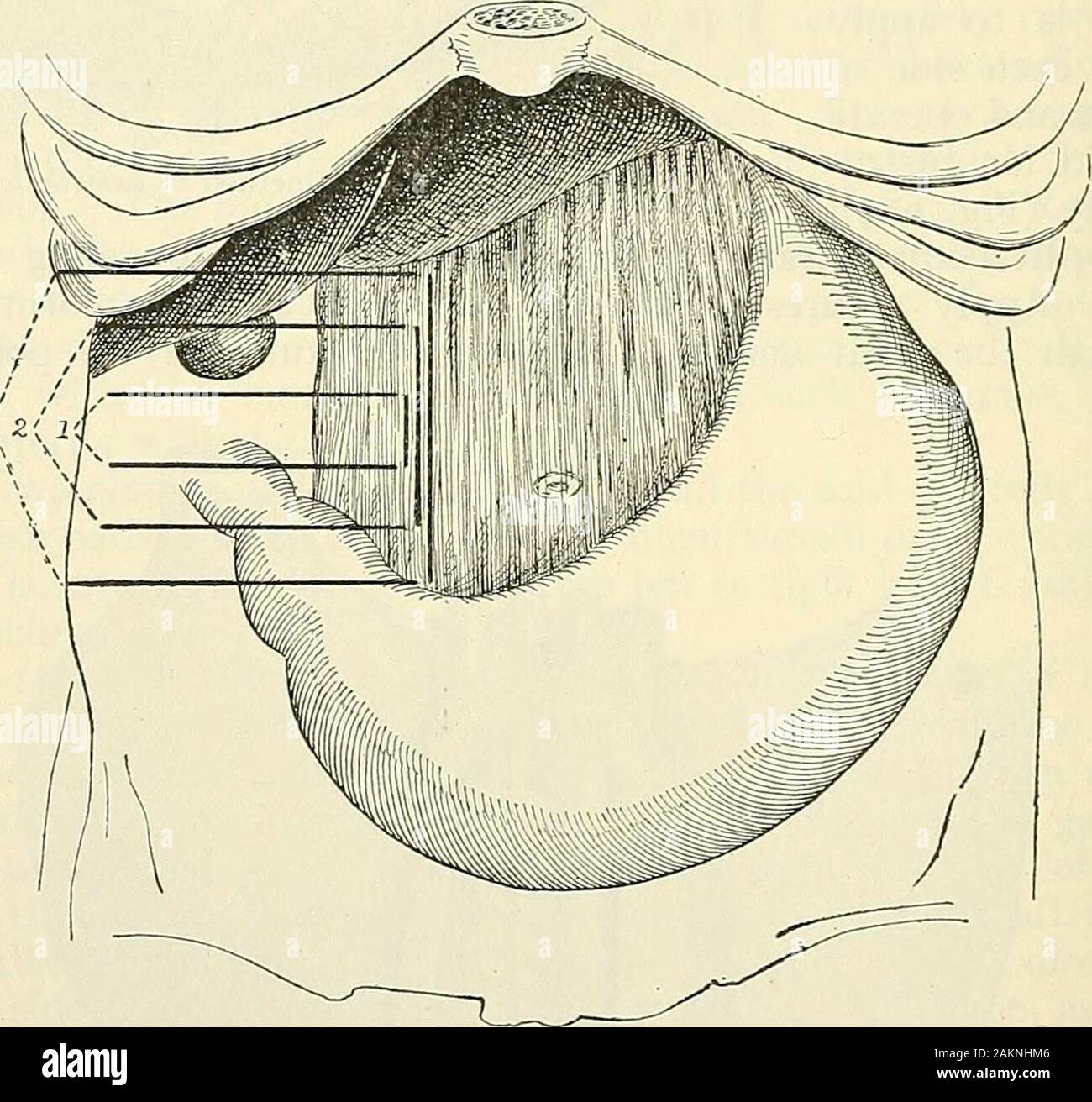 Modern surgery, general and operative . value, and must never be used ...