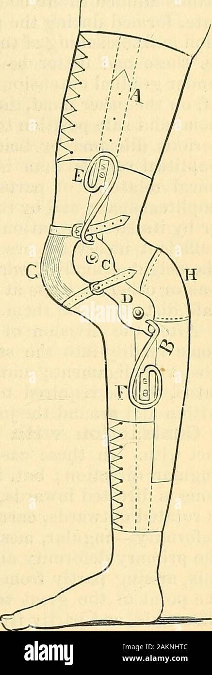 Skin traction hi-res stock photography and images - Alamy