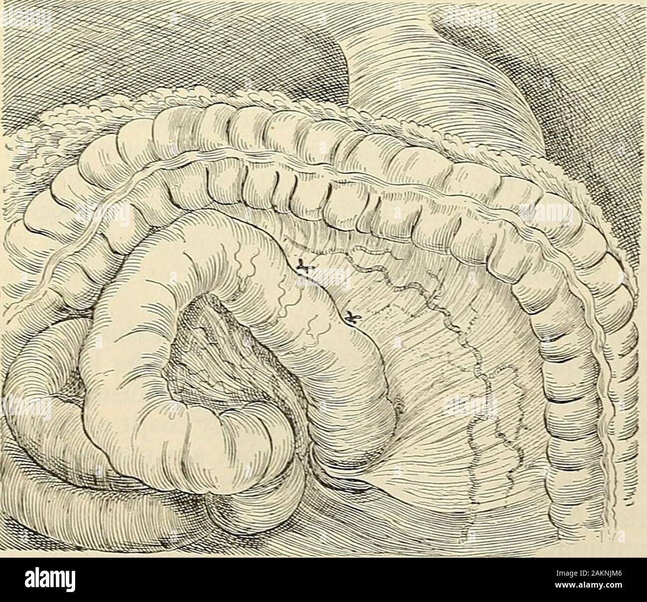 Modern surgery, general and operative . Fig. 681.—Ma3-os method of ...