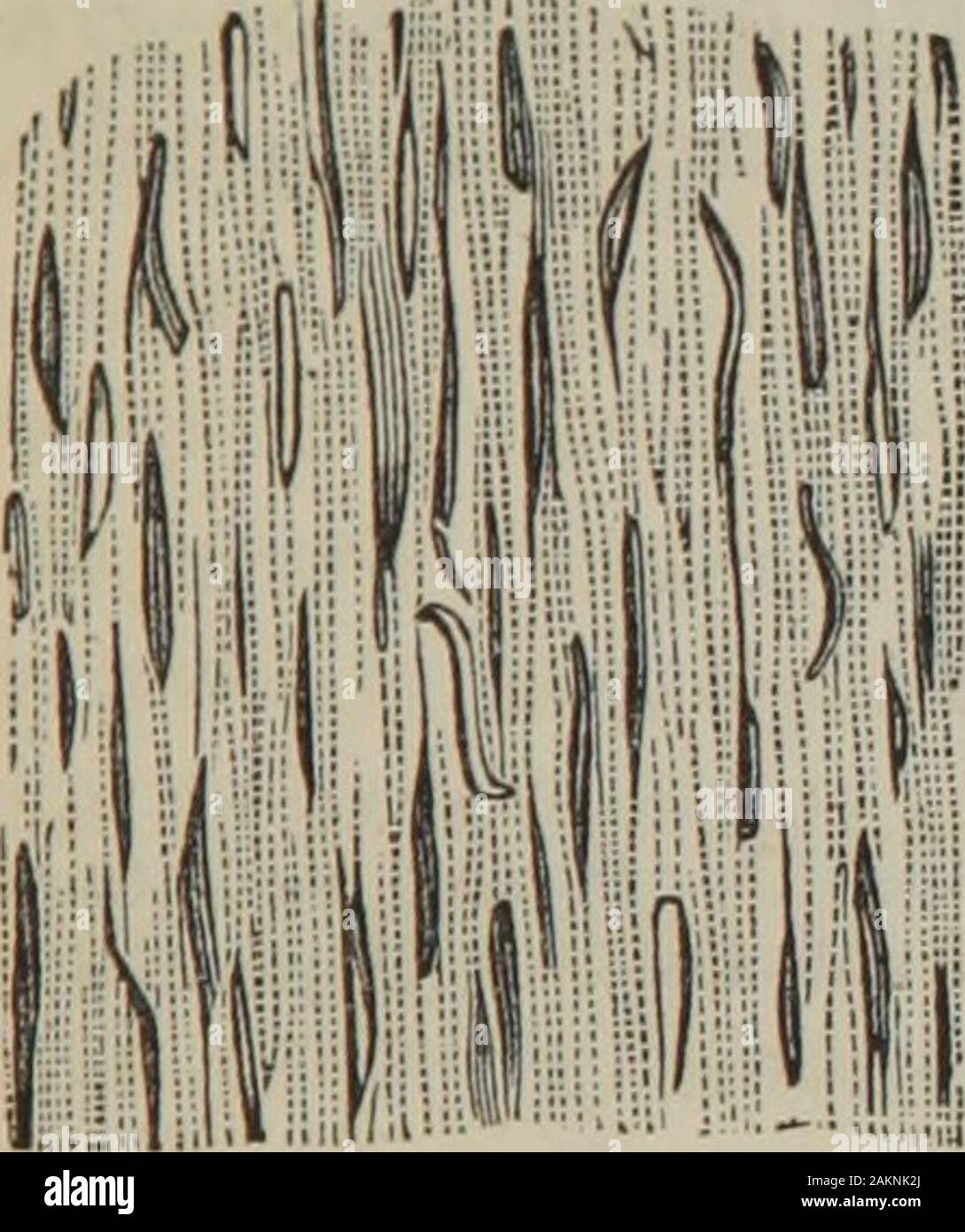 Coagulum Fibrin High Resolution Stock Photography and Images - Alamy