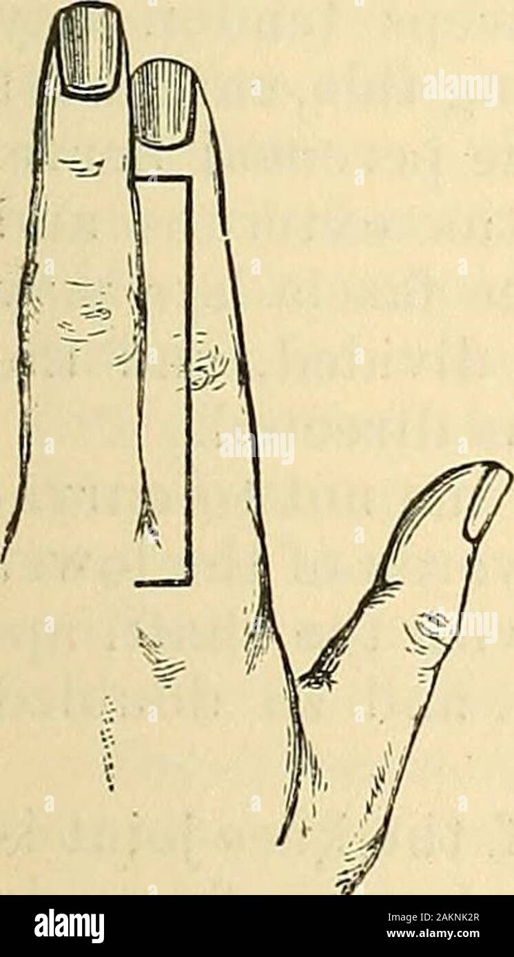 Hand down middle finger back hi-res stock photography and images - Alamy