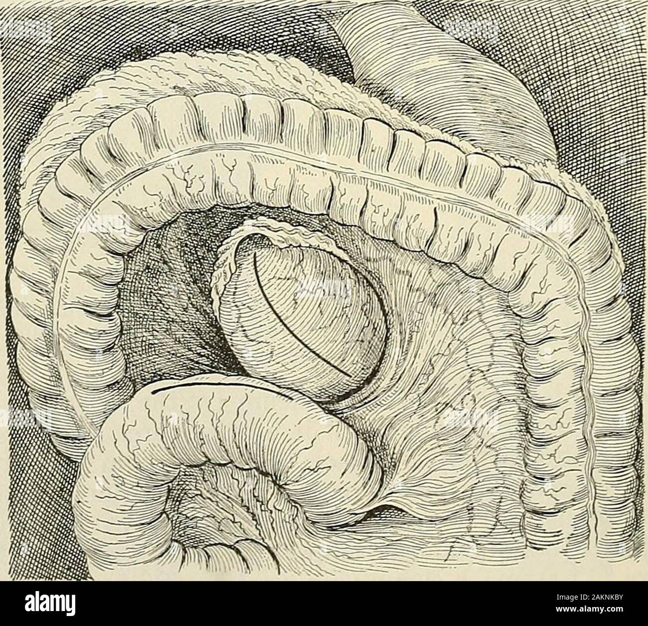 Modern surgery, general and operative . i / ? 1 - -- . / , Fig. 679 ...