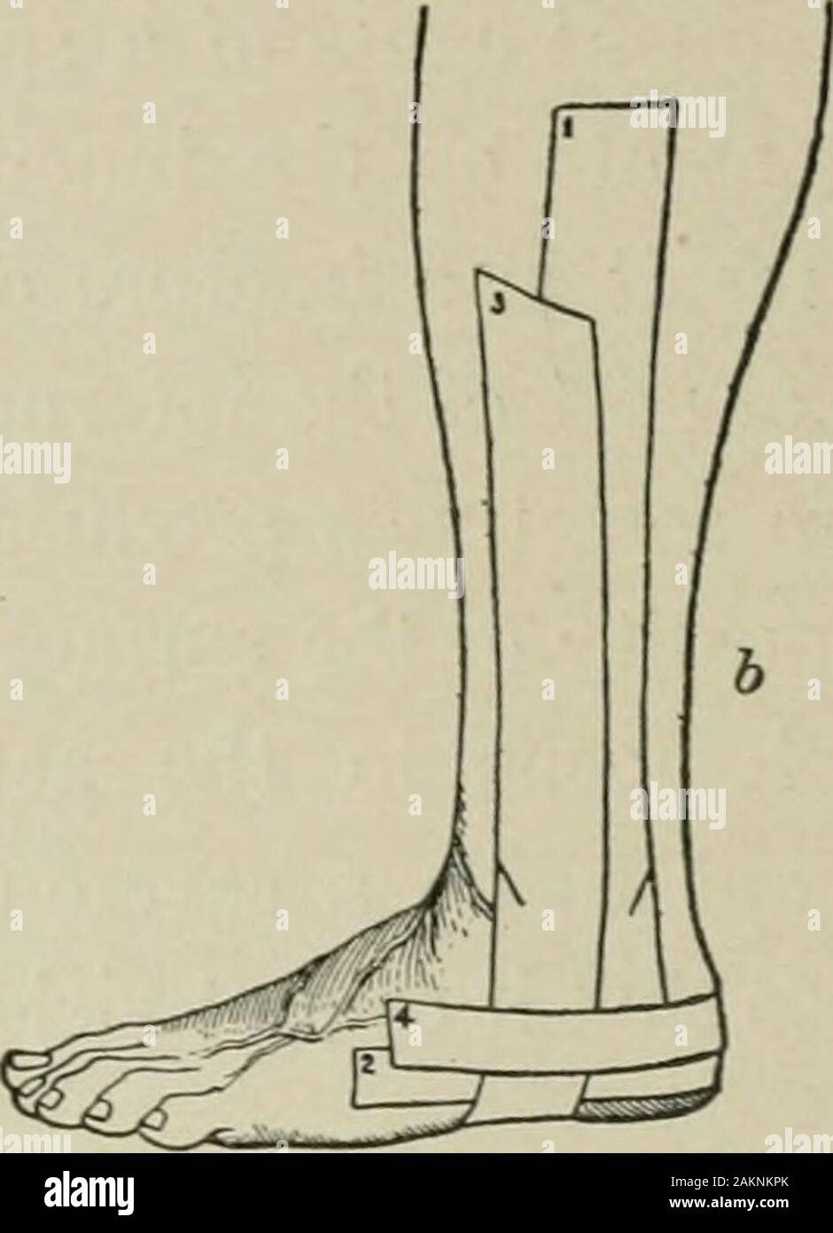 American practice of surgery : a complete system of the science and art ...