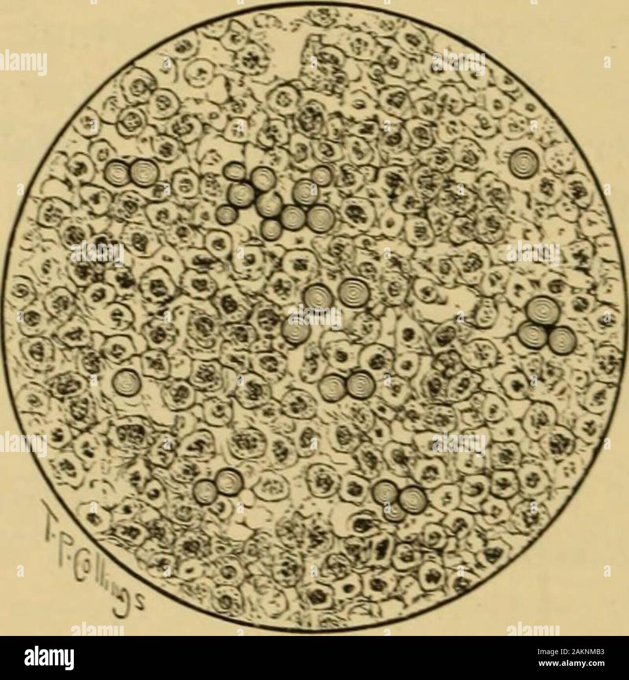 Mucous membrane in the nose hi-res stock photography and images - Alamy