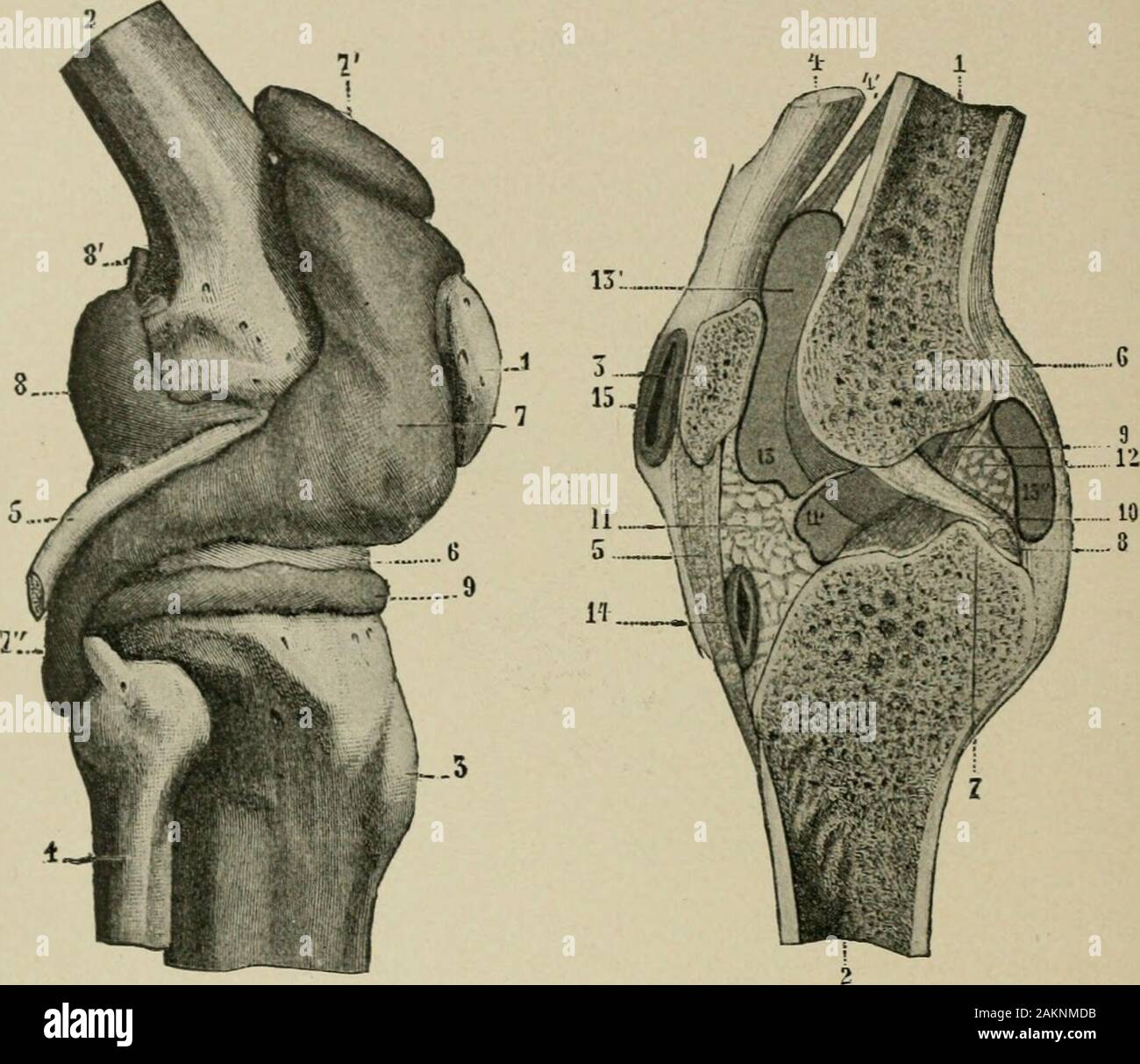 Pyaemia hi-res stock photography and images - Alamy