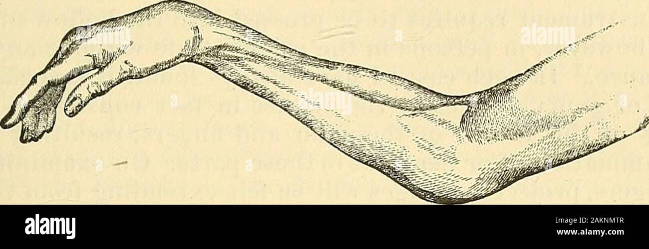 The science and art of surgery : being a treatise on surgical injuries ...