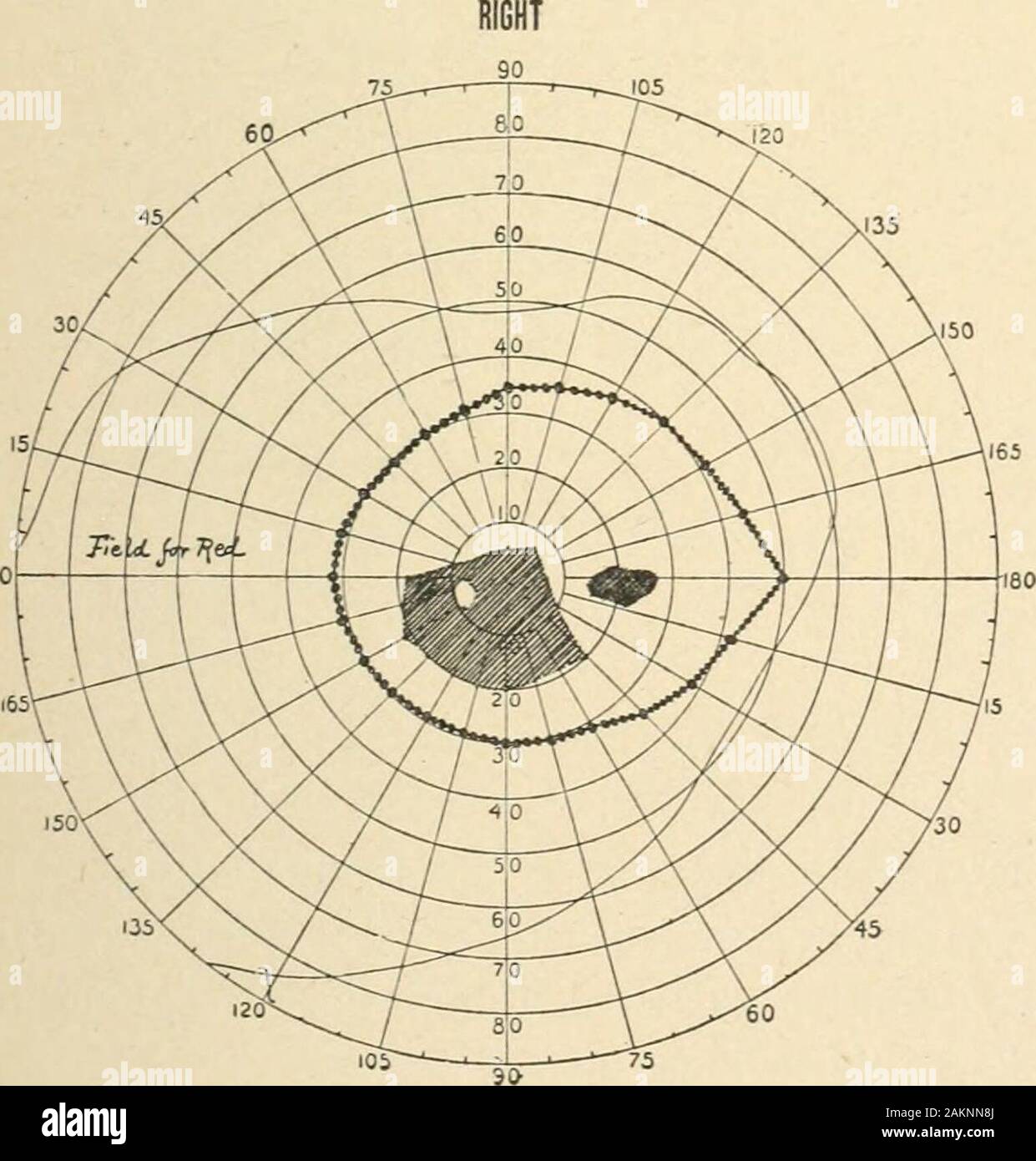 Fusion simul hi-res stock photography and images - Alamy