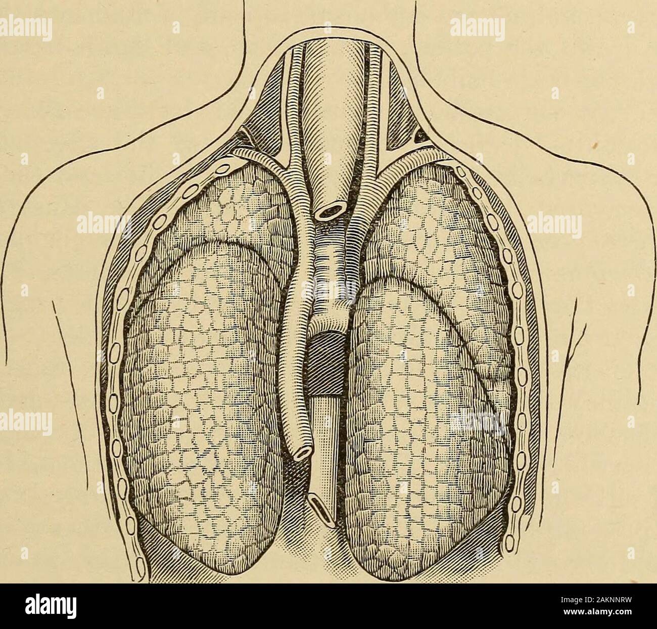 Bronchial rupture hi-res stock photography and images - Alamy