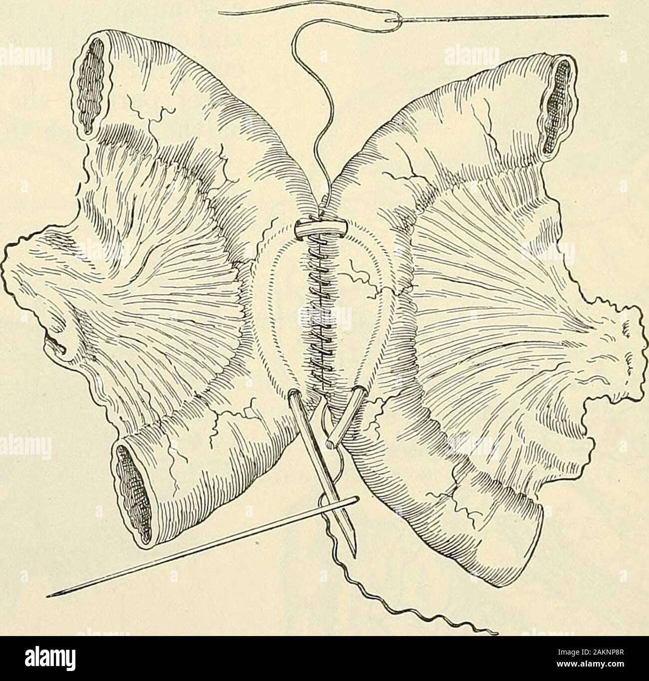 Modern surgery, general and operative . ature and at the lowest ...