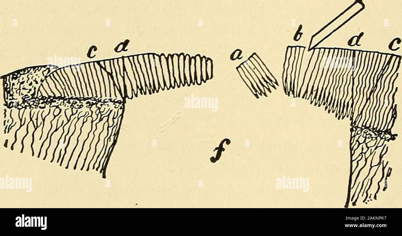 Principles and practice of operative dentistry . Round. Inverted cone ...