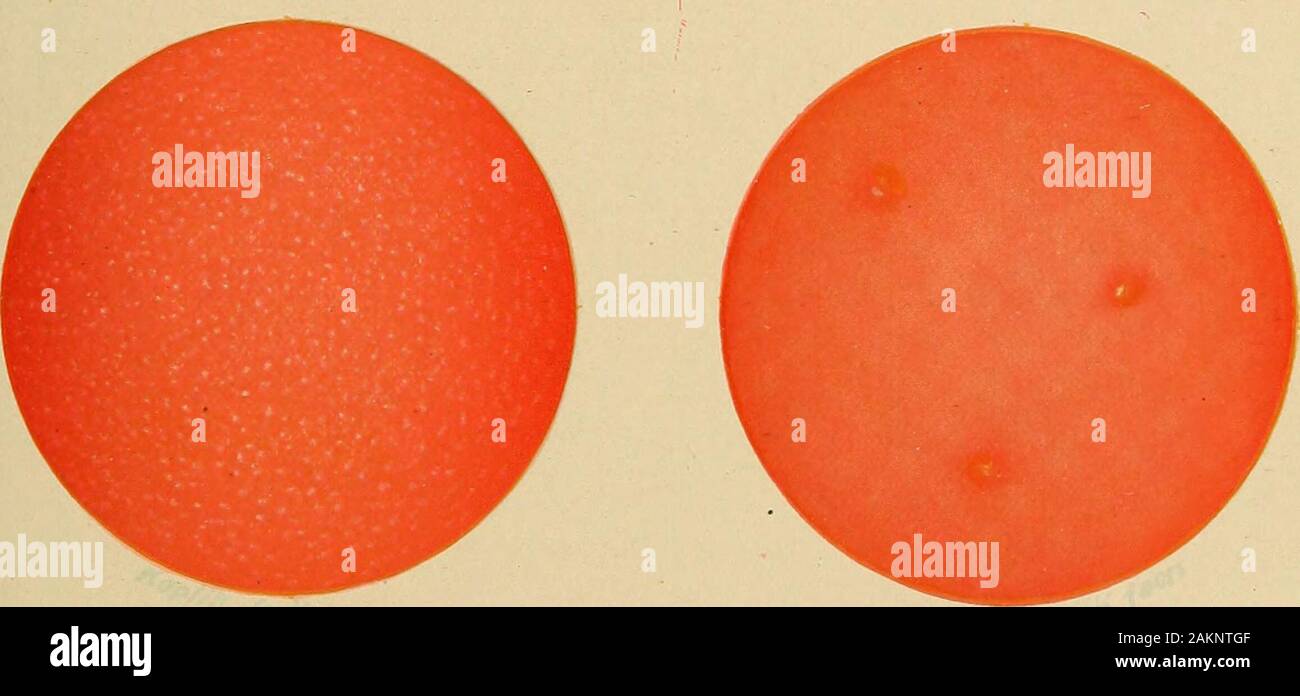 A treatise on the principles and practice of medicine . FIG. 3 FIG. 4 ...