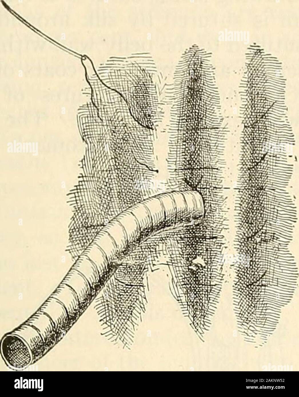 Mikulicz High Resolution Stock Photography and Images - Alamy