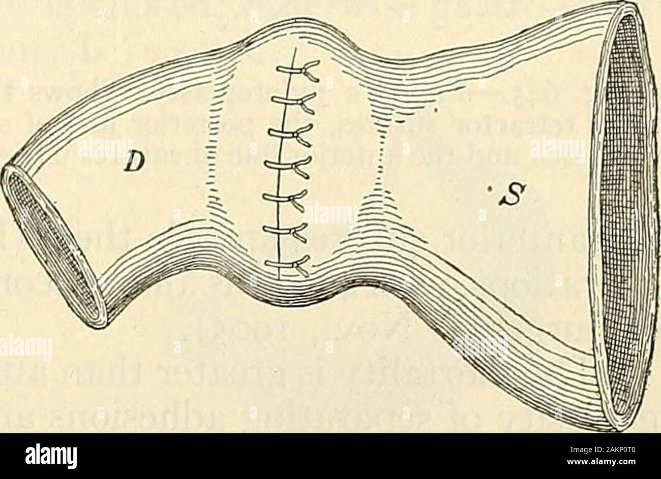 Modern surgery, general and operative . s pyloroplasty: Theincision ...