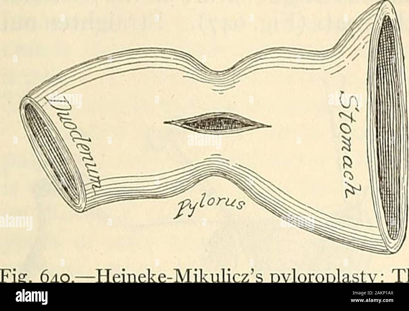 Modern surgery, general and operative . ical line (Fig. 641). The ...