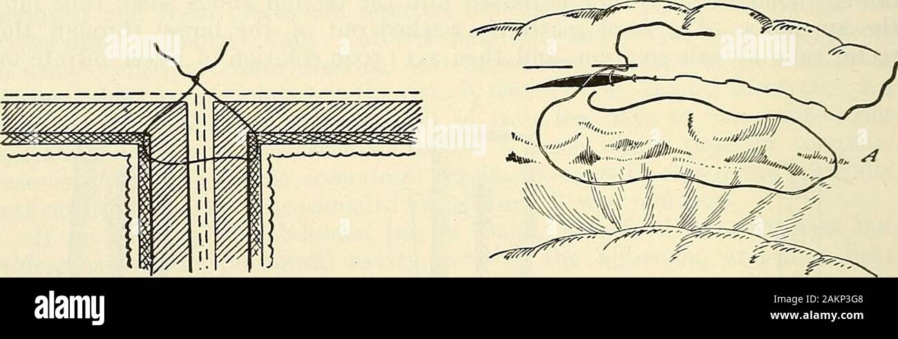 Peritoneum serous membrane hi-res stock photography and images - Alamy