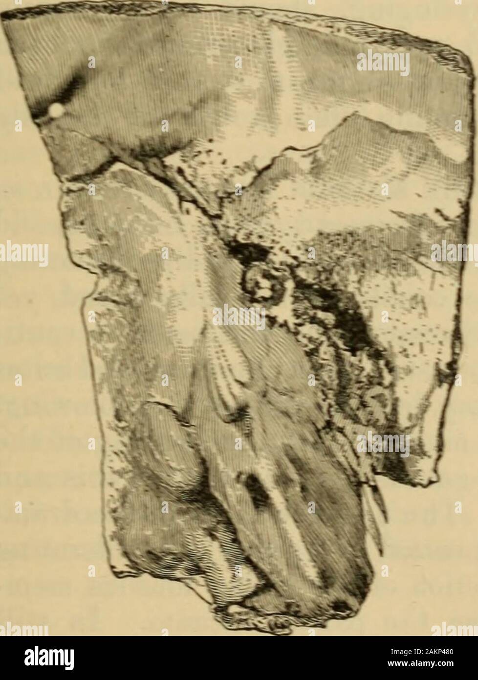An American text-book of the diseases of children .. . Portion of Base ...