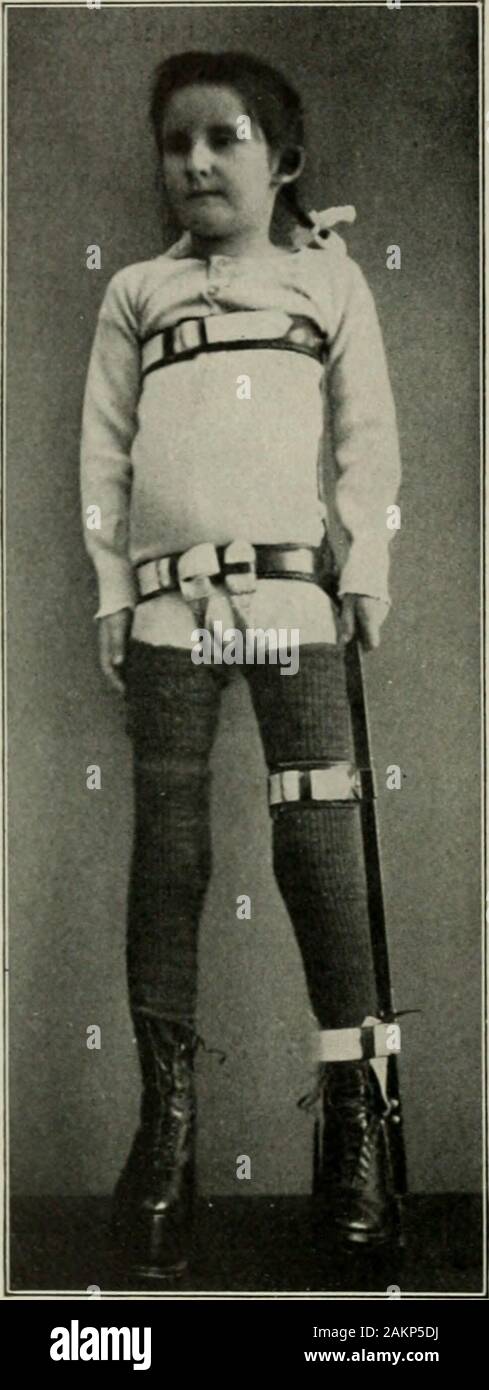 Metal soles hi-res stock photography and images - Alamy