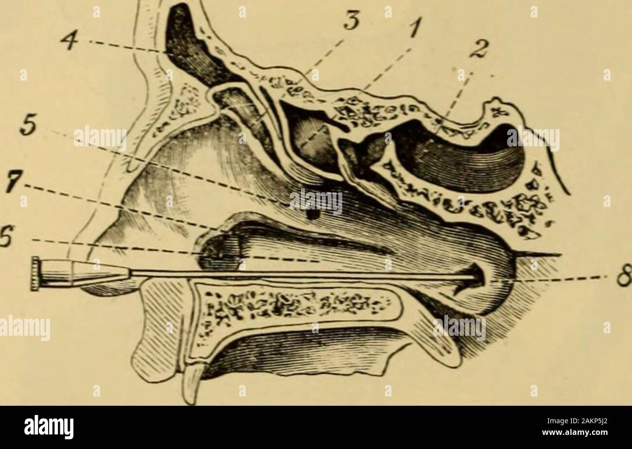 Aural examination hi-res stock photography and images - Alamy