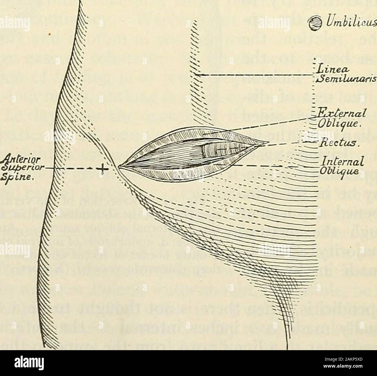 Anterior Rectus Sheath
