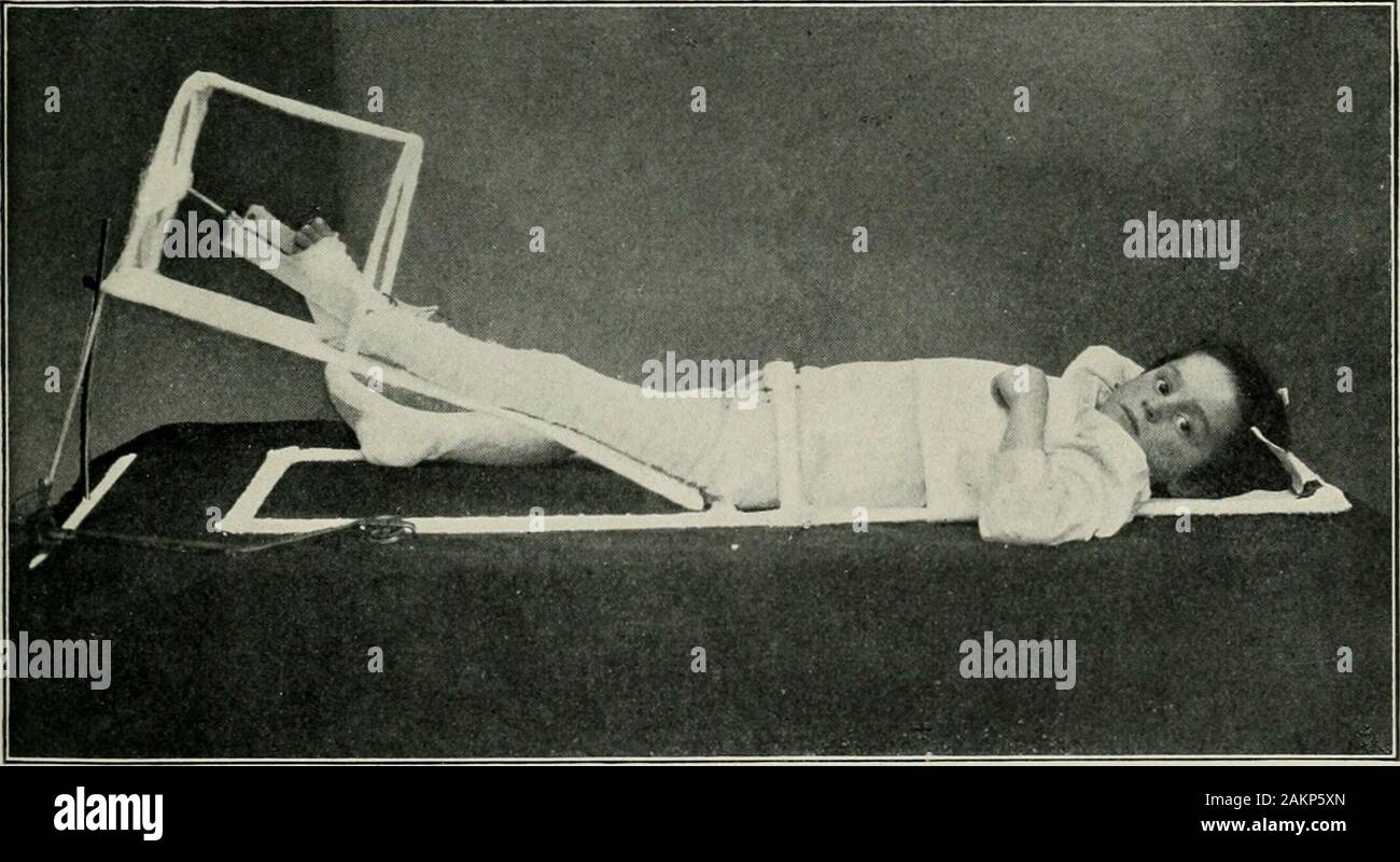 American practice of surgery : a complete system of the science and art ...