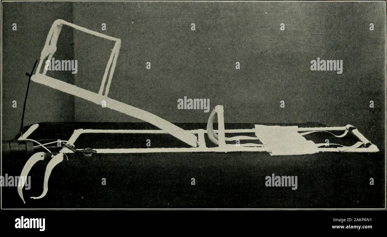 Thomas splint hi-res stock photography and images - Alamy