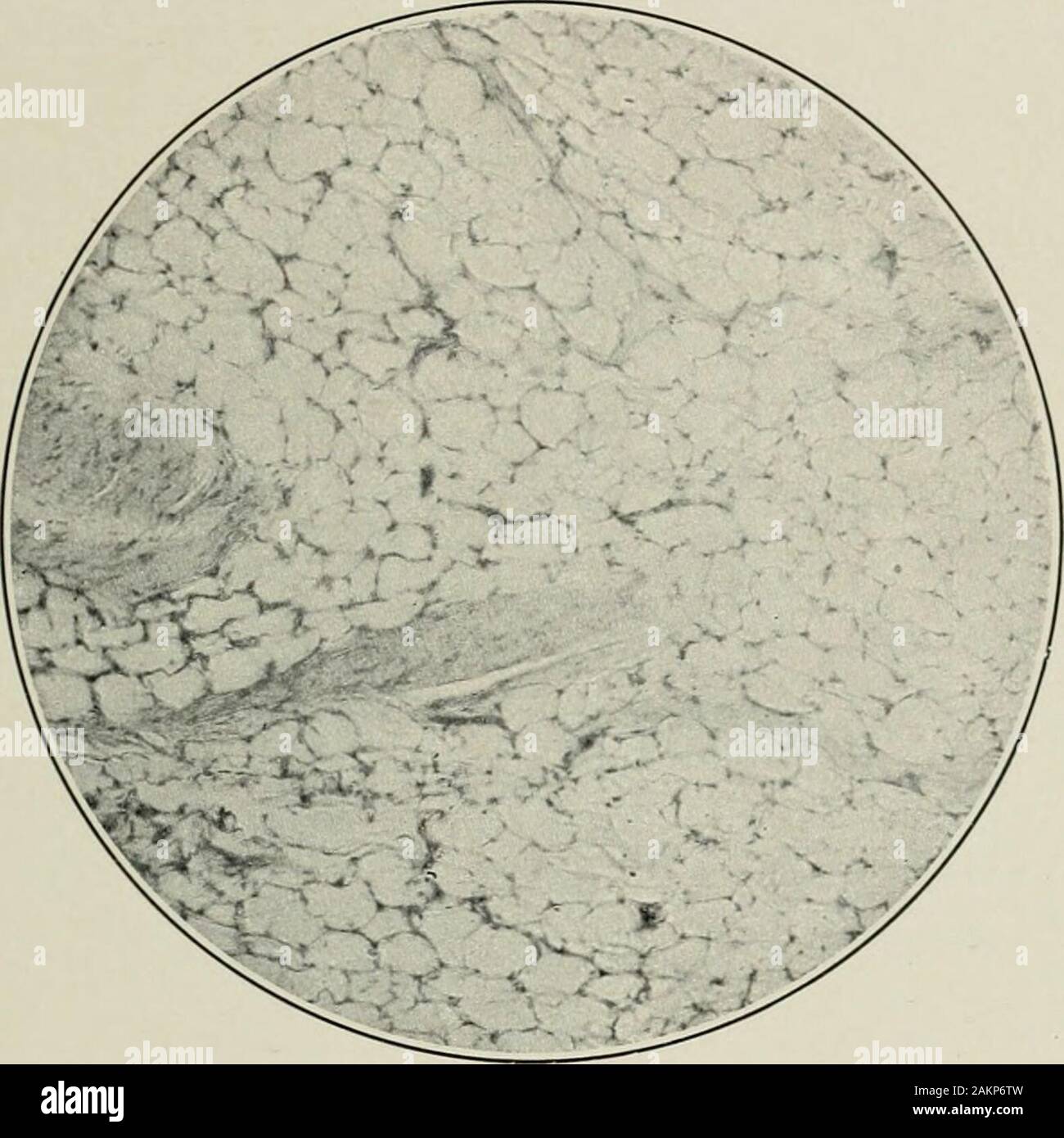 American practice of surgery : a complete system of the science and art ...