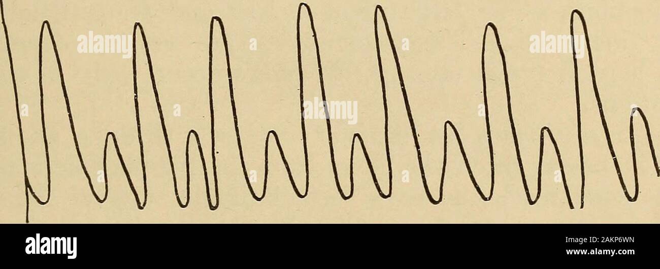 Segmentary hi-res stock photography and images - Alamy