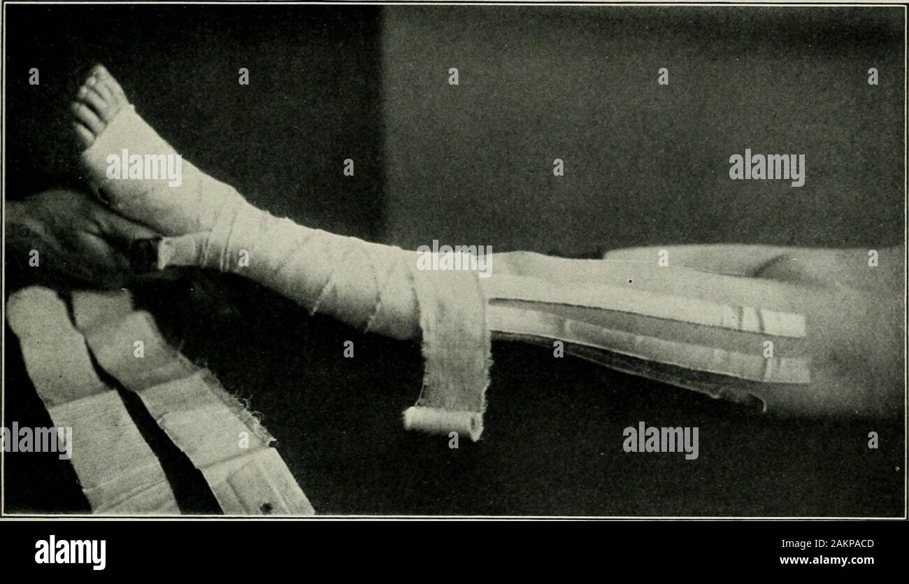Joints of upper limb hi-res stock photography and images - Alamy