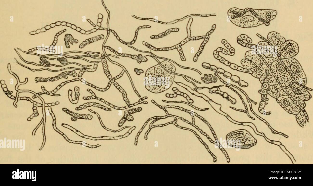 Hair under a microscope hi-res stock photography and images - Alamy