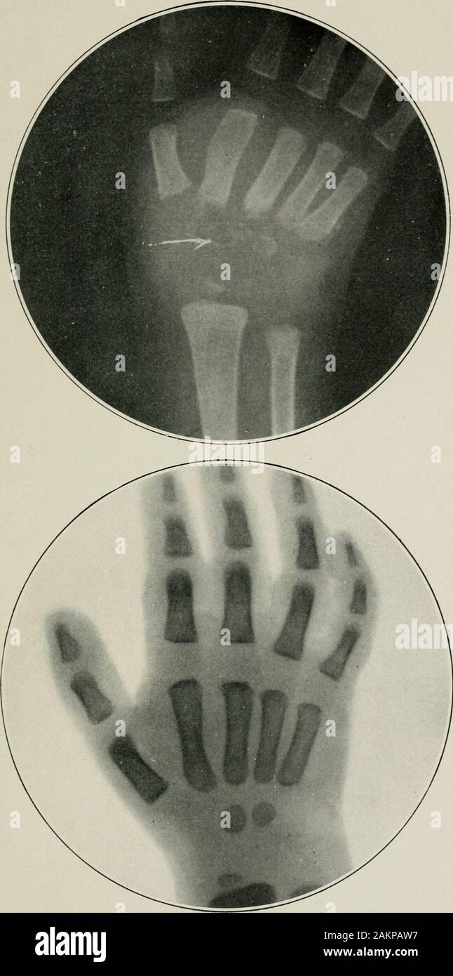 American practice of surgery : a complete system of the science and art ...